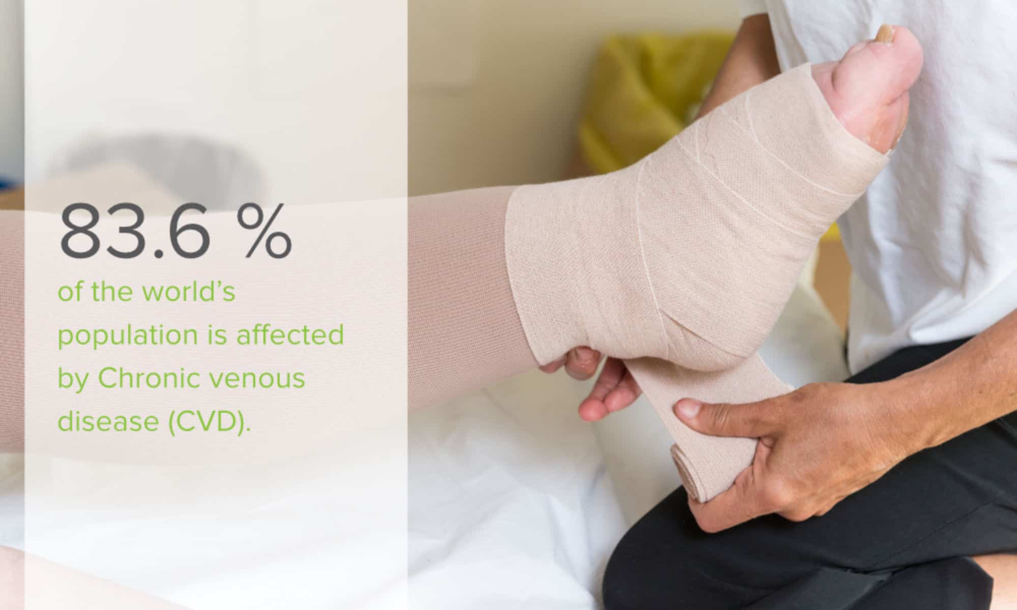 Ankle-Brachial Index (ABI) is vitally important in effective ...