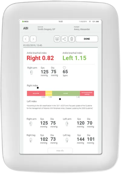 Why Measure Ankle Brachial Index (ABI) - Hibernia Medical NI