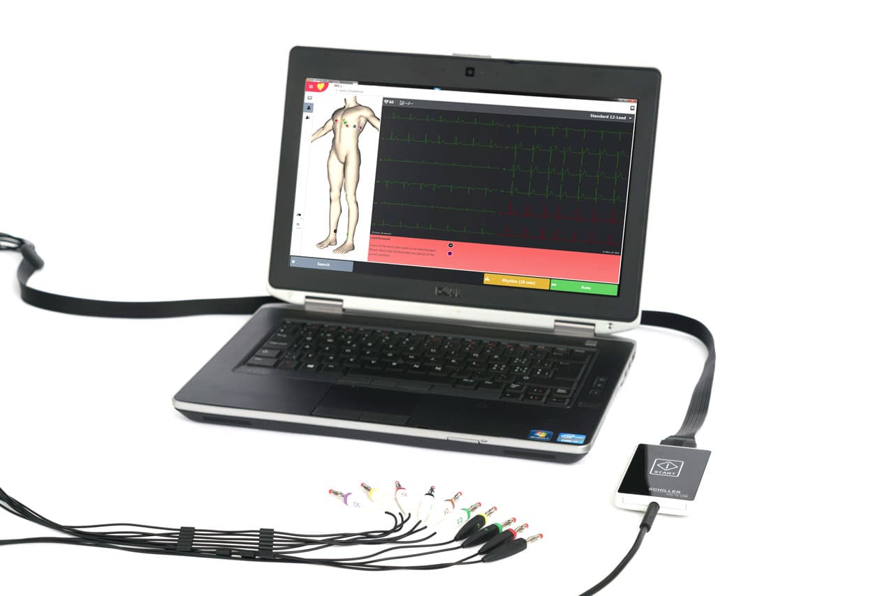 Schiller Cardiovit CS-104 PC Based Resting ECG System - Quarterly ...